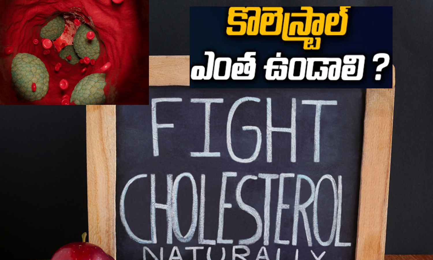 High cholesterol: symptoms, treatment and prevention details